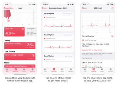 What is your Apple Watch trying to tell you about your health? | Cult ...